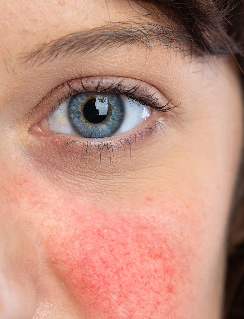 Médecine vasculaire - Dr Gandillet Fréjus Saint Raphaël